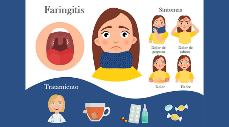 Los síntomas de la faringitis y por qué puede derivar en otras ...